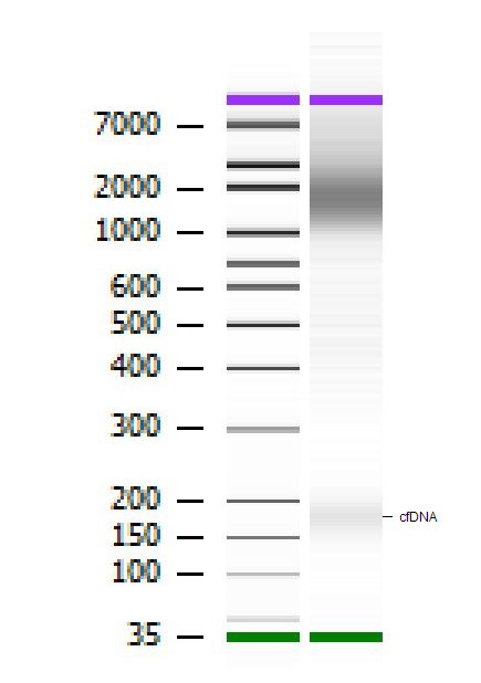 Isopure Plasma cfDNA Isolation Kit - Aline Biosciences LLC